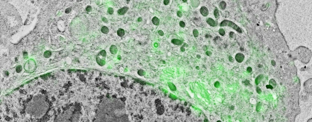 What is Correlative Light and Electron Microscopy? What is Correlative Light and Electron Microscopy?