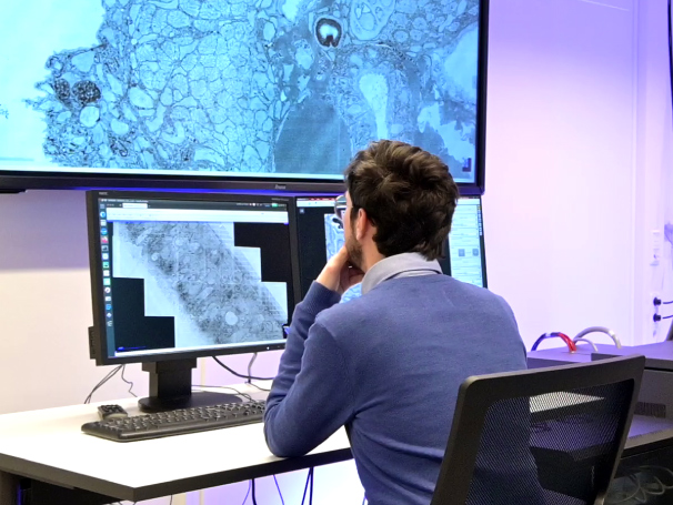 FAST-EM | Ultra-fast automated multibeam electron microscope