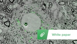 Correlative light and electron microscopy fundamentals