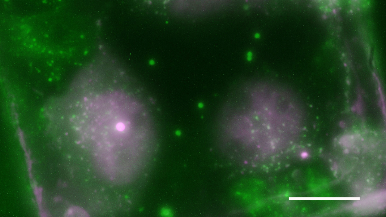 Neuroscience | Integrated cryo-CLEM solutions for neuroscience
