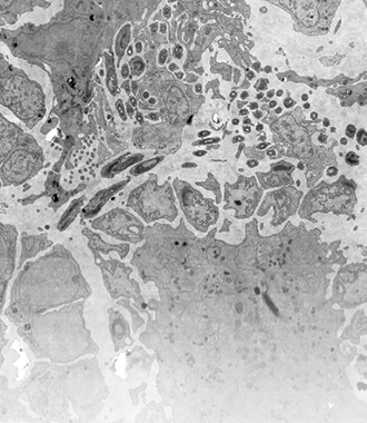 FAST-EM | Ultra-fast automated multibeam electron microscope