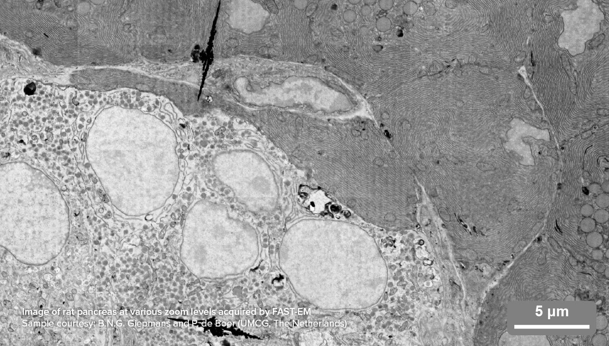 FAST-EM | Ultra-fast automated multibeam electron microscope