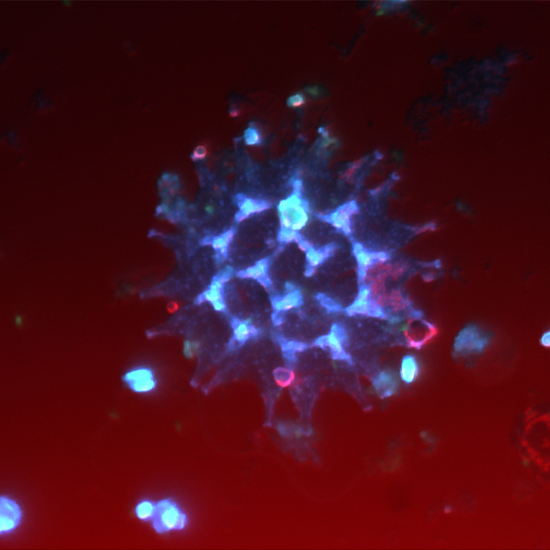 Marine microbiology | Integrated CLEM for marine microbiology