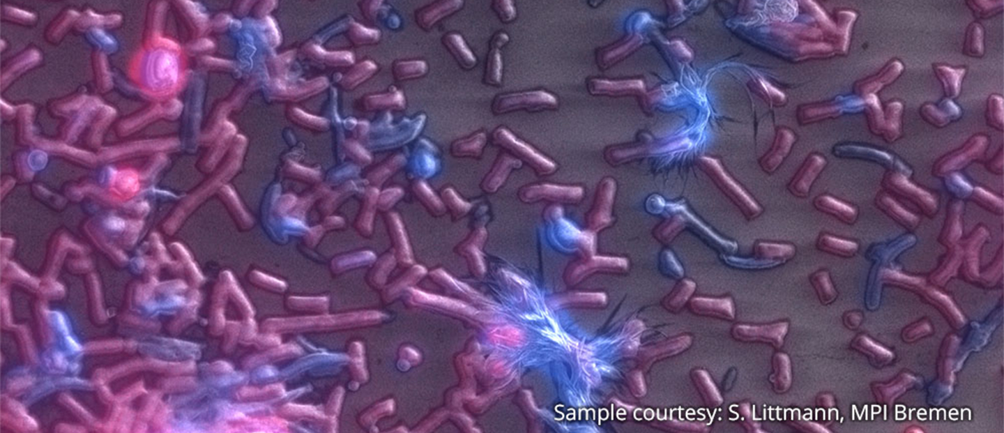 Marine microbiology | Integrated CLEM for marine microbiology