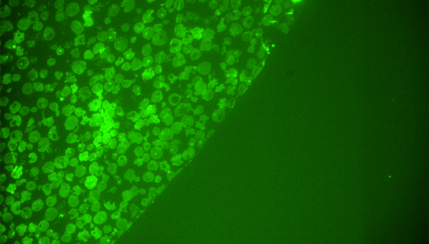 Virology | Study viruses with integrated CLEM to understand their ...