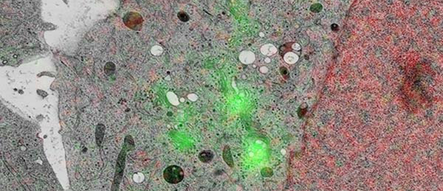 Cell Biology | Study cellular processes with high resolution ...