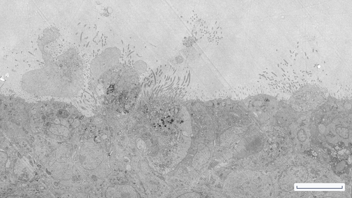 FAST-EM | Ultra-fast automated multibeam electron microscope