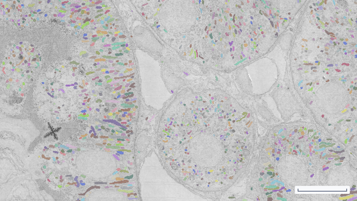 FAST-EM | Ultra-fast automated multibeam electron microscope