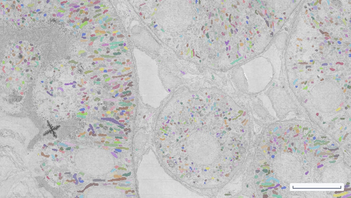 FAST-EM | Ultra-fast automated multibeam electron microscope