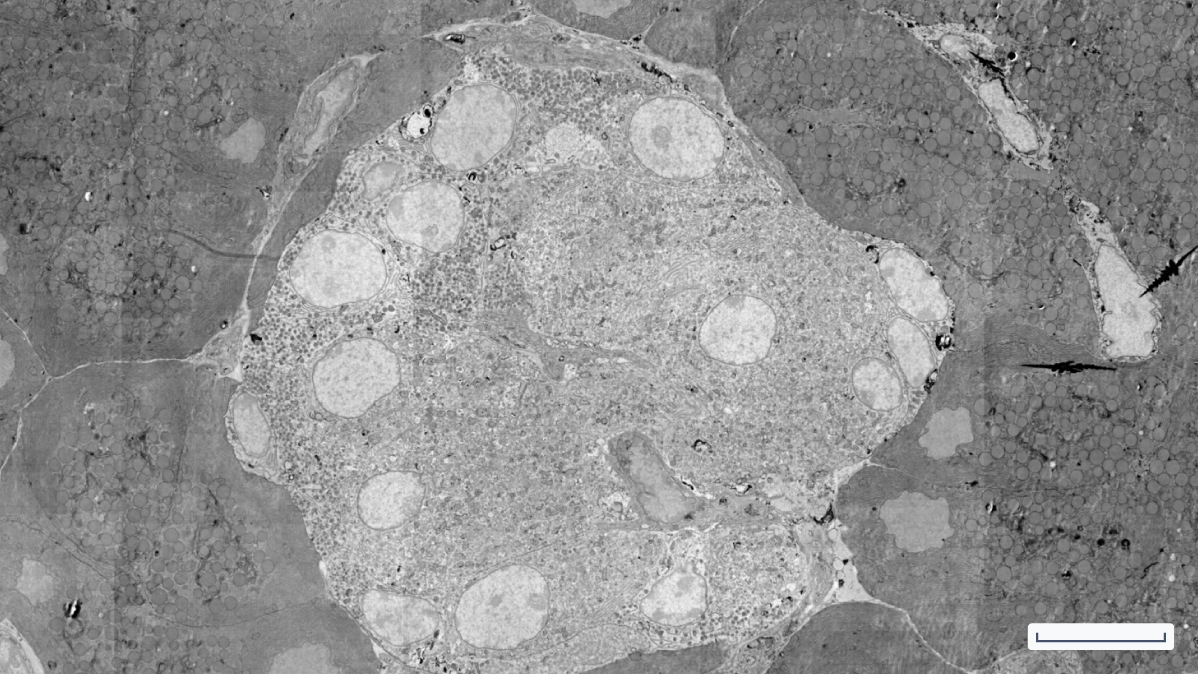 FAST-EM | Ultra-fast automated multibeam electron microscope
