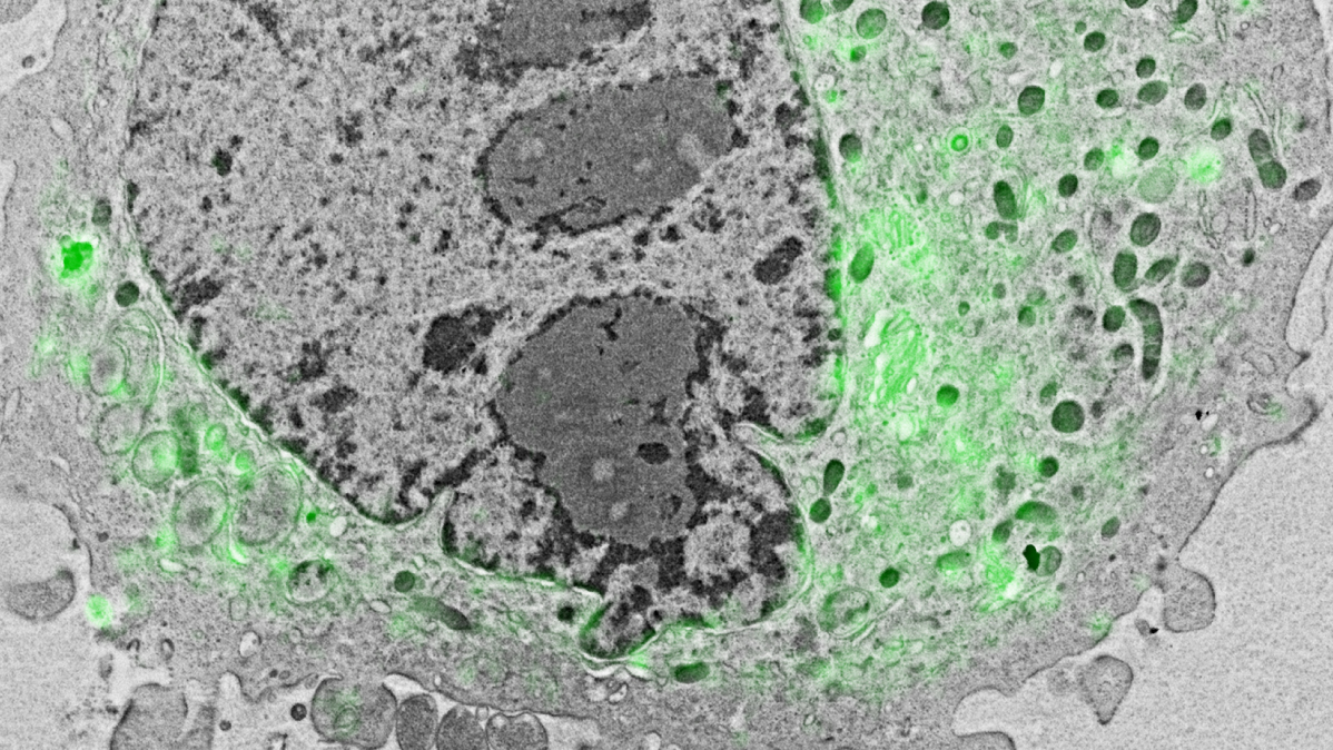 SECOM | Ultrastructure and fluorescence imaging in one CLEM system