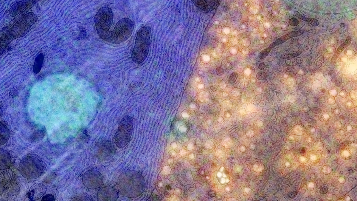 SECOM | Ultrastructure and fluorescence imaging in one CLEM system